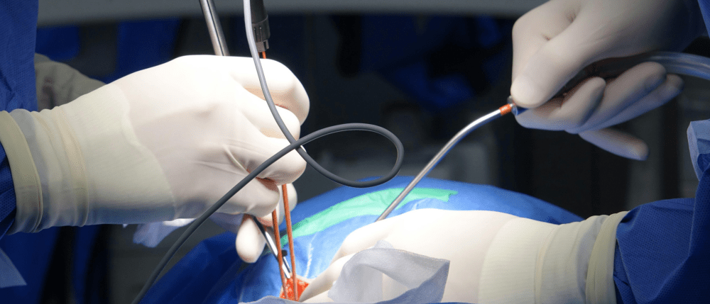 Surgical Gloves | Sterile Latex-Free & Polyisoprene – Birth Supplies Canada